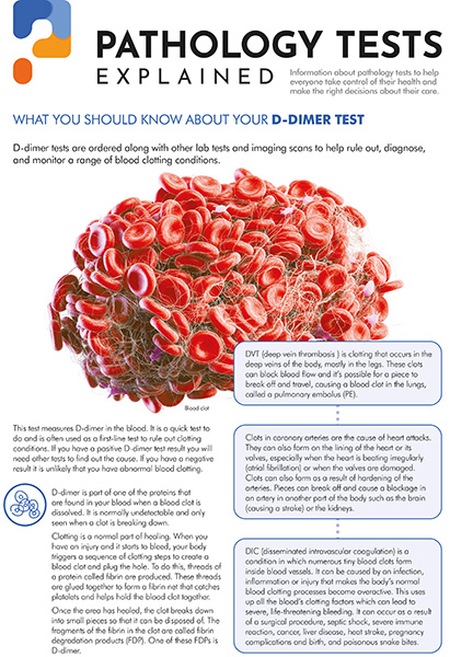 D-dimer | Pathology Tests Explained
