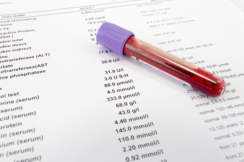 Pathology Tests Explained | Tips on reading your results