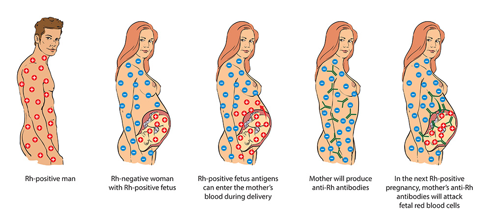 Antenatal group and screen | Pathology Tests Explained