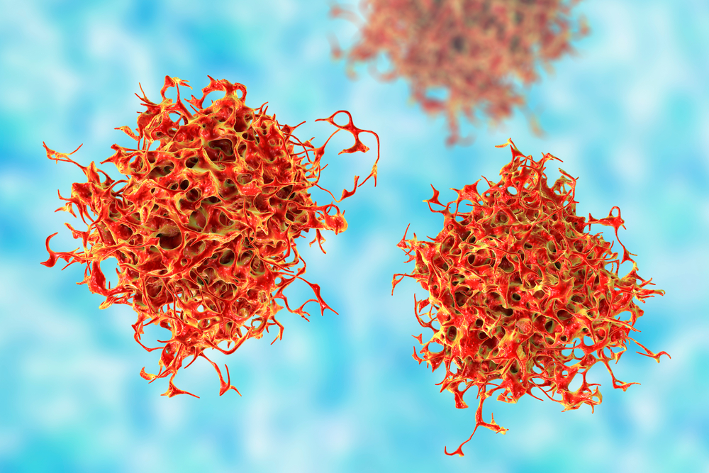 Carcinoembryonic Ag (CEA) | Pathology Tests Explained