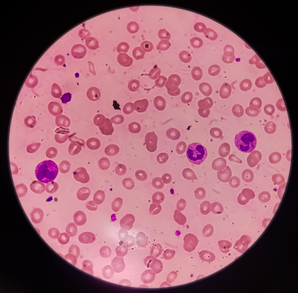 Vitamin B12 and folate | Pathology Tests Explained